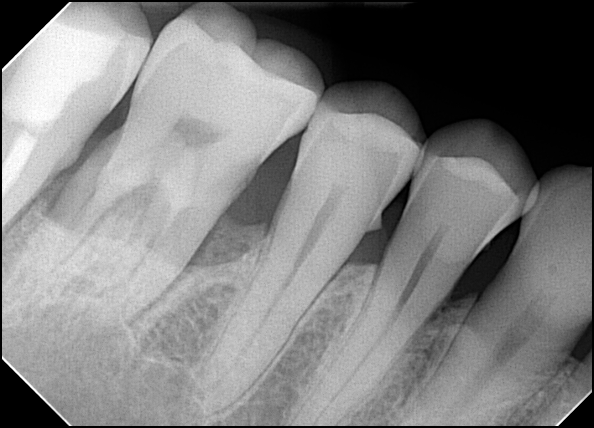 Eva Select Digital Sensors